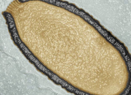 Ancient Virus ‘Resurrected’ From 30,000-Year-Old Ice In Siberia | James ...
